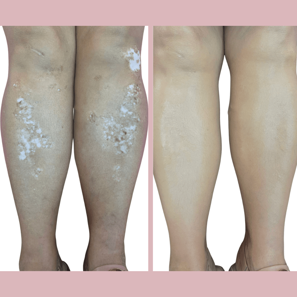 Bombshell Body & Leg Makeup - 100ml | 3.4 fl.oz - Best Bronze